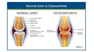 Presentation on Osteo Arthritis Disorder.pptx