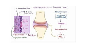 Presentation on Osteo Arthritis Disorder.pptx