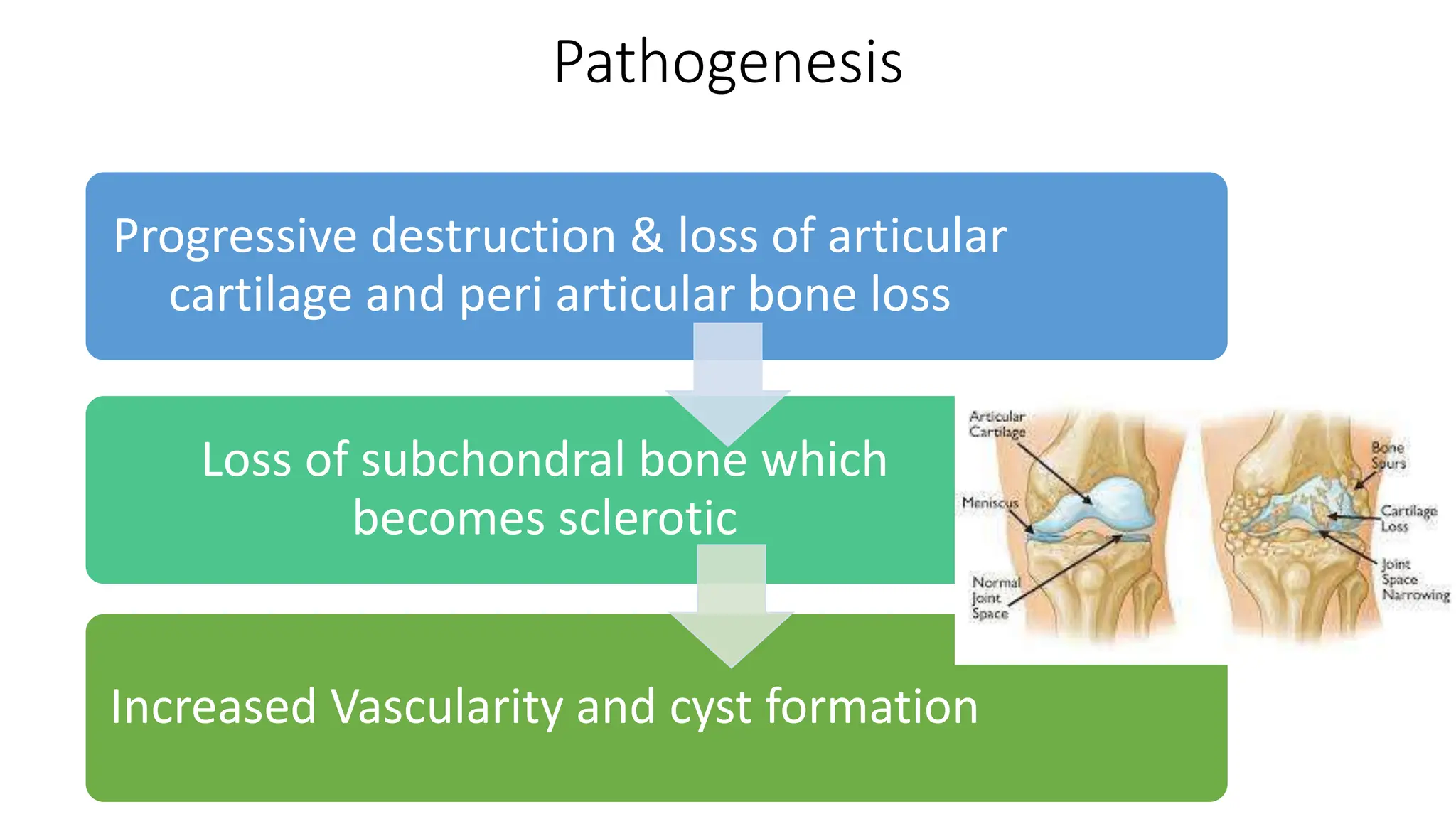 Osteoarthritis (Nutshell) | PPTX
