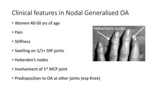 Osteoarthritis (Nutshell) | PPTX