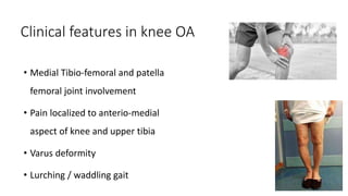 Osteoarthritis (Nutshell) | PPTX