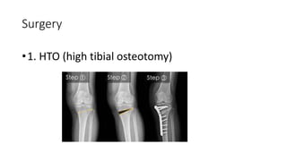 Osteoarthritis (Nutshell) | PPTX