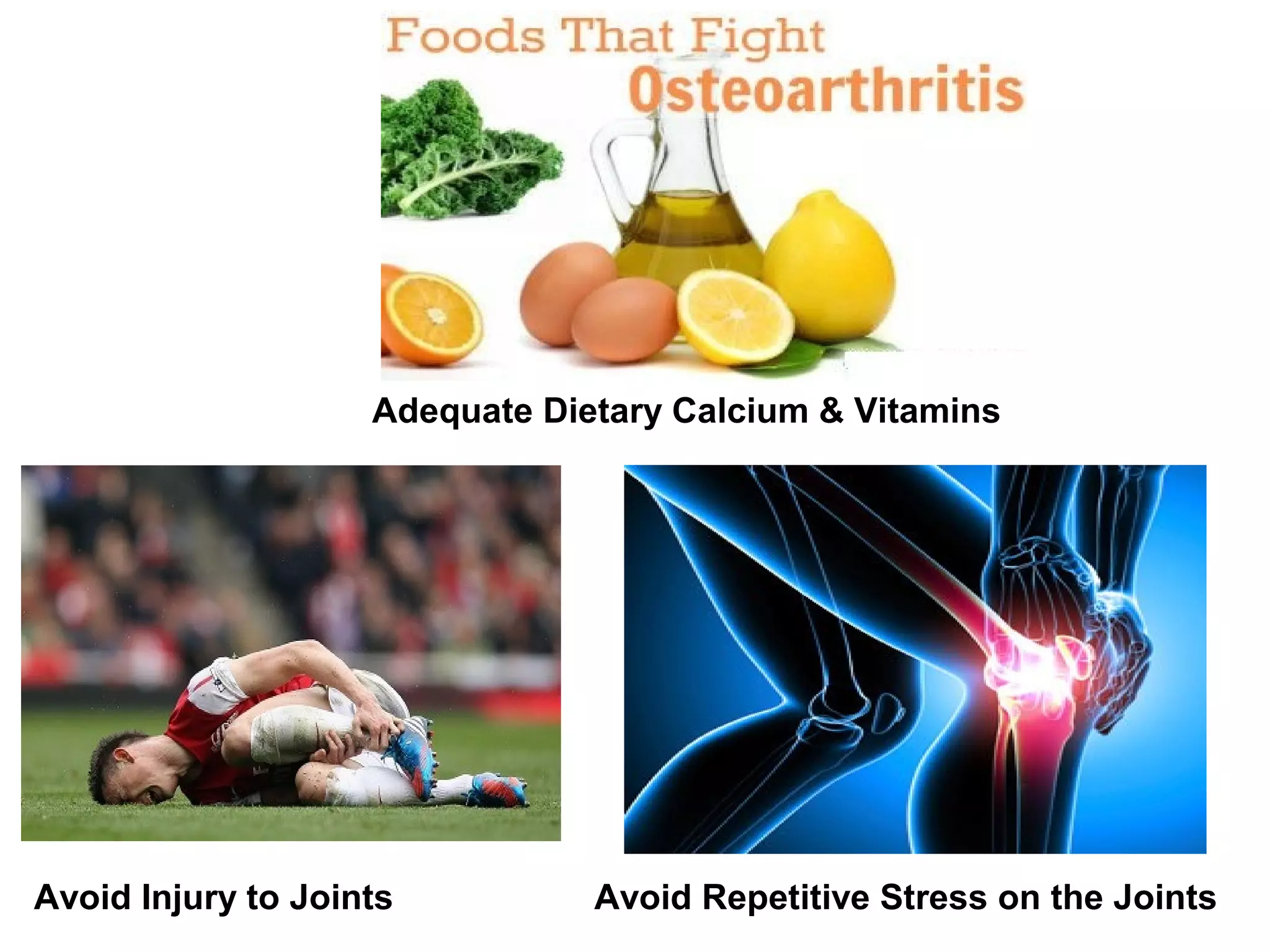 Osteoarthritis Patient Education Handout | National Education