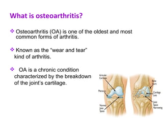 Osteoarthritis patient-education | PPT