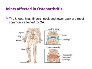Osteoarthritis patient-education | PPT