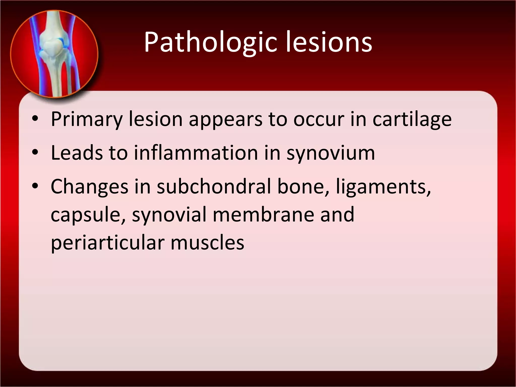 Osteoarthritis | PPT