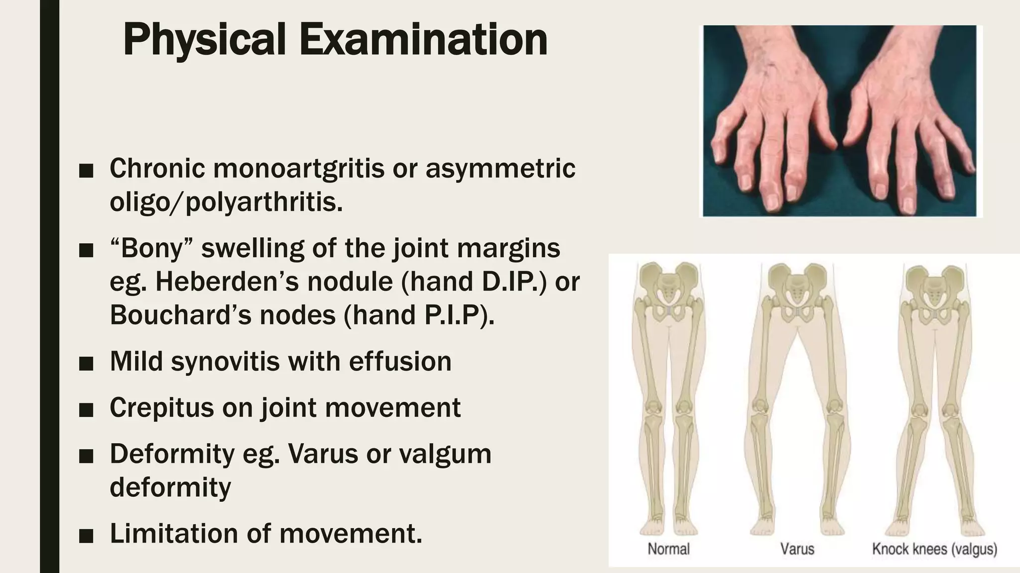 osteoarthritis ppt.pptx