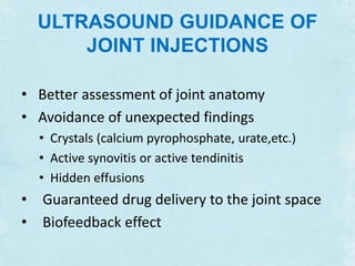 Osteoarthritis Treatment Alternatives | PPT