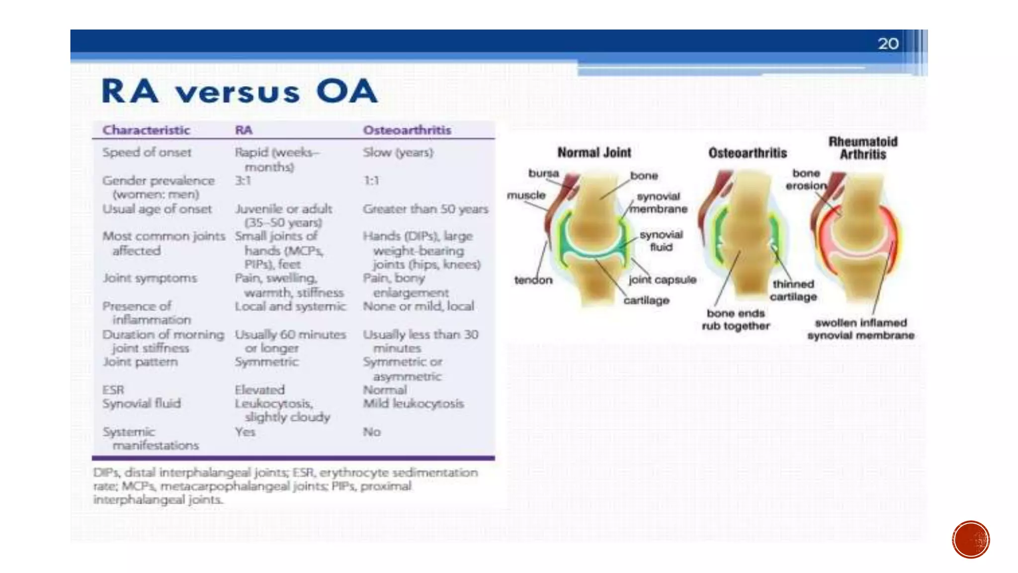 Osteoarthritis and rheumatoid arthritis | PPTX