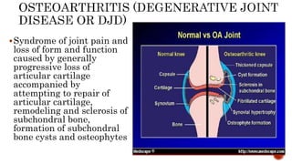 Osteoarthritis and rheumatoid arthritis | PPTX