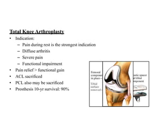 osteoarthritisknee-170221145316.pptx
