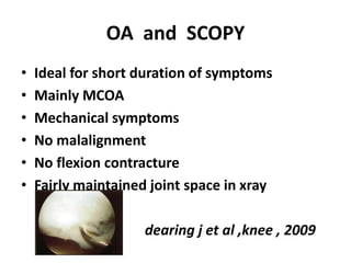 Osteoarthritis knee joint preservation options -dr mohamed ashraf,hod ...
