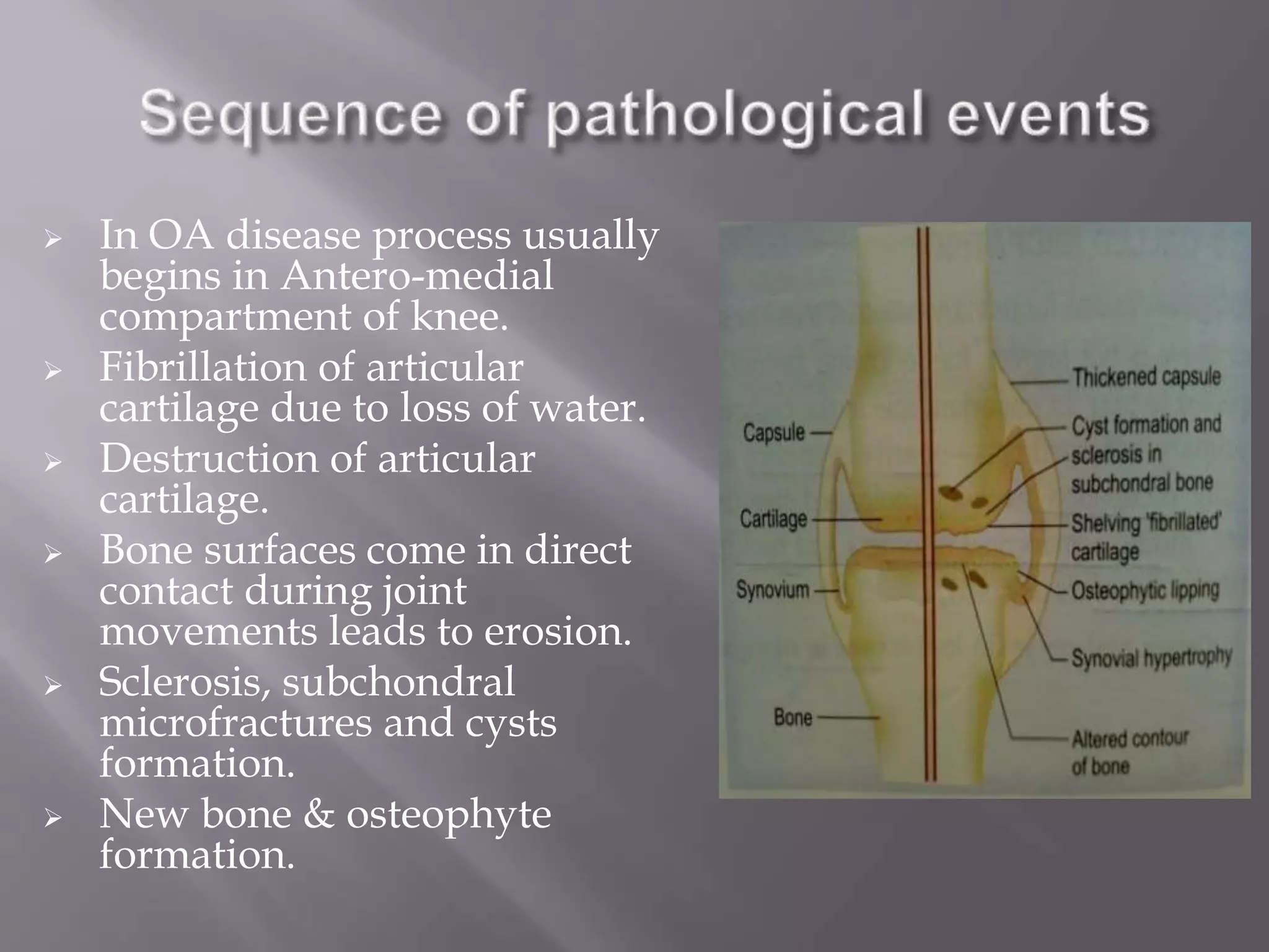 Osteoarthritis of Knee Joint | PPTX