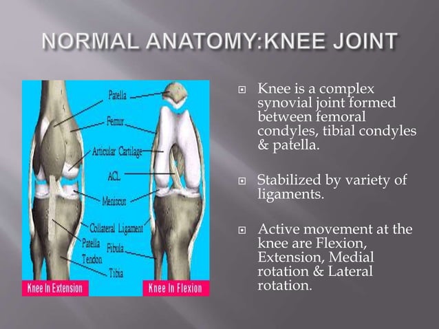 Osteoarthritis of Knee Joint | PPTX