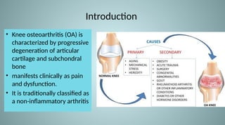osteoarthritis of the knee and stages(1).pptx