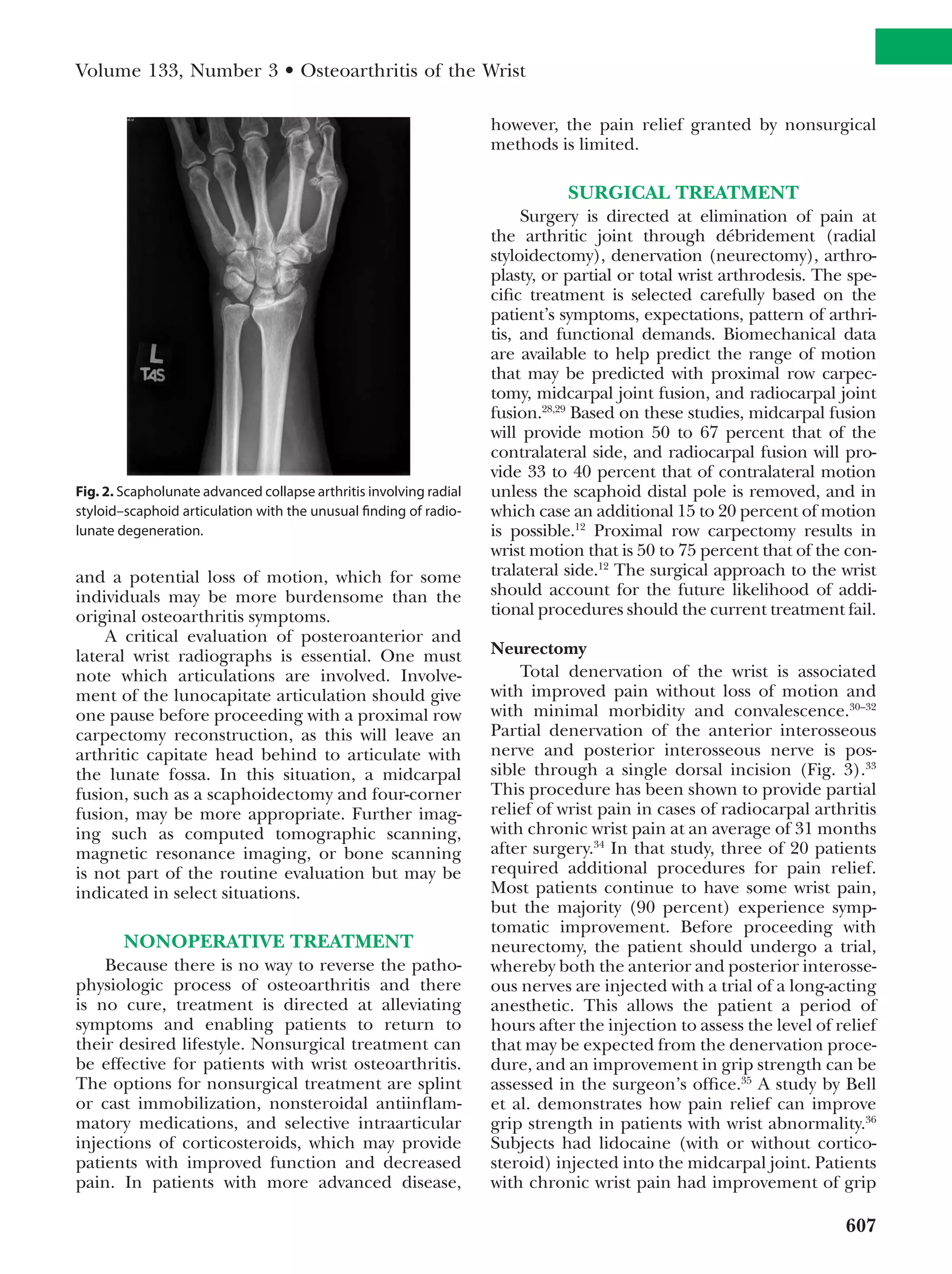 Osteoarthritis of the_wrist from Mayo Clinic | PDF