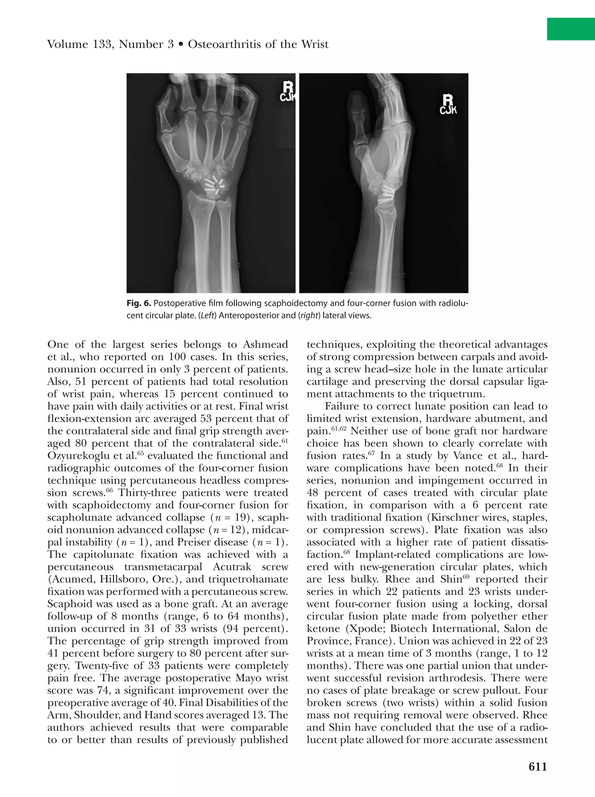 Osteoarthritis of the_wrist from Mayo Clinic | PDF