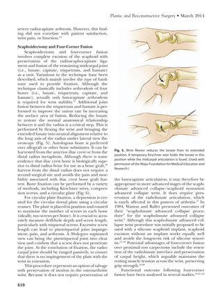 Osteoarthritis of the_wrist from Mayo Clinic | PDF