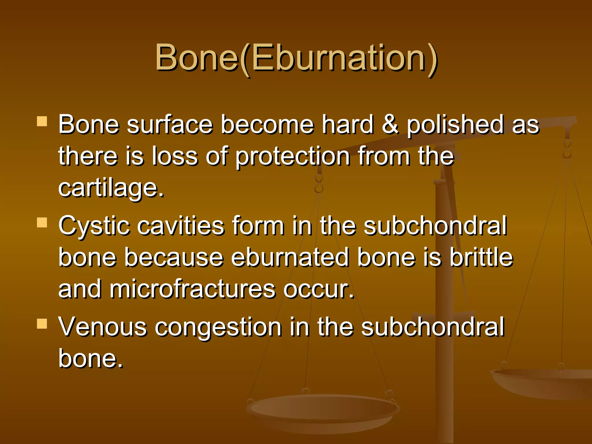 Osteoarthritis ppt | PPT