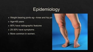 OSTEOARTHRITIS PRESENTATION ISHA.pptx