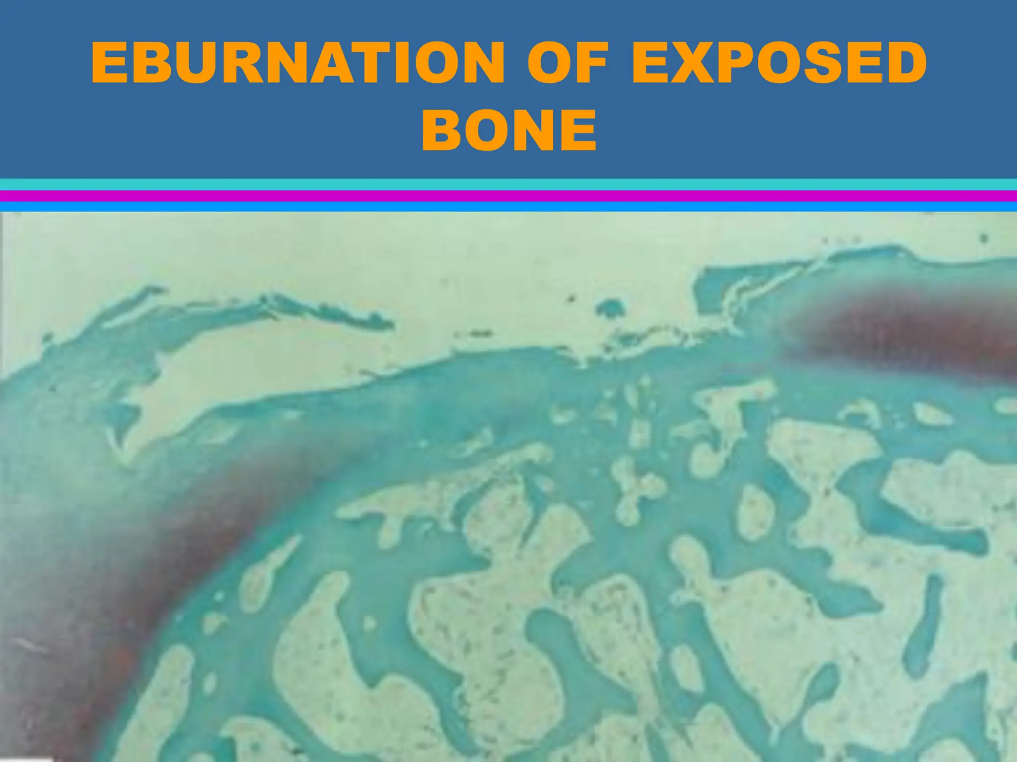 Osteoarthritis students final (1)_231128_124819.pdf