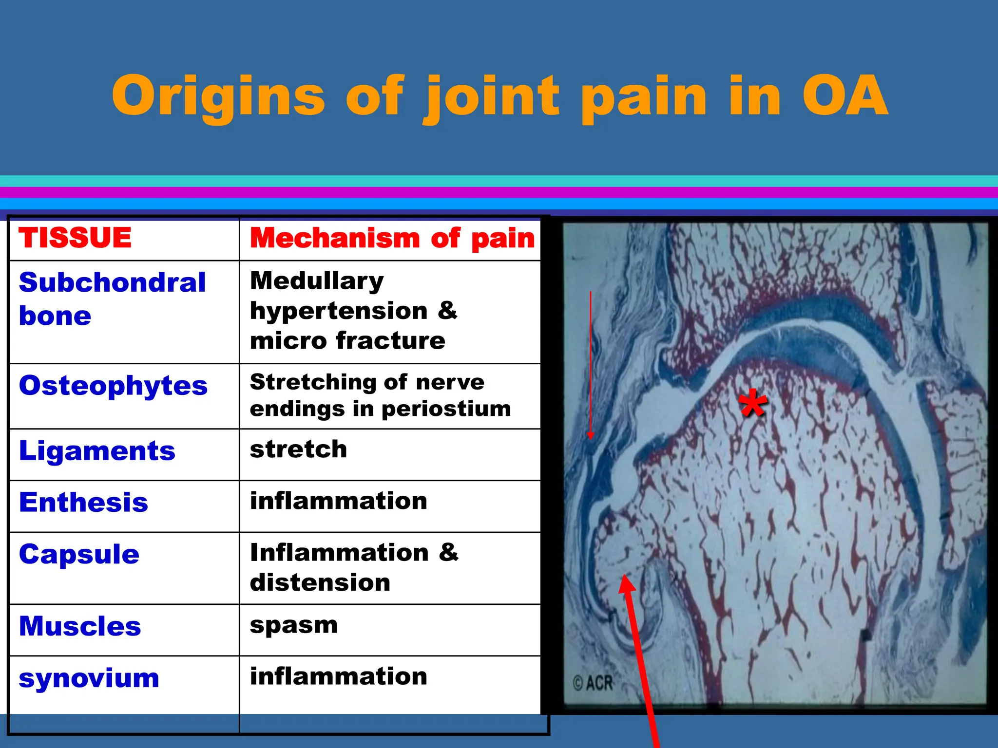 Osteoarthritis students final (1)_231128_124819.pdf