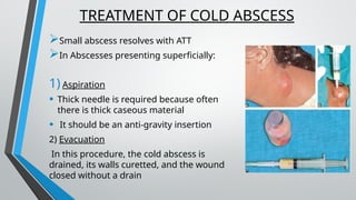 Osteoarticular TB Seminar by Abhilash Nair | PPT