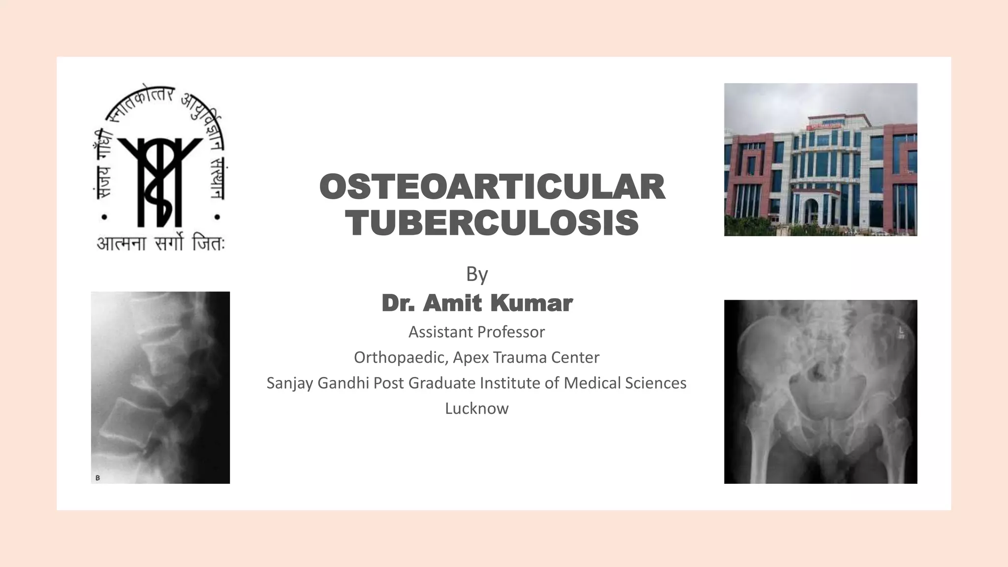 Osteoarticular tuberculosis | PPTX