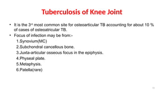 Osteoarticular Tuberculosis knee and spine | PPTX