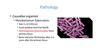 Osteoarticular Tuberculosis knee and spine | PPTX