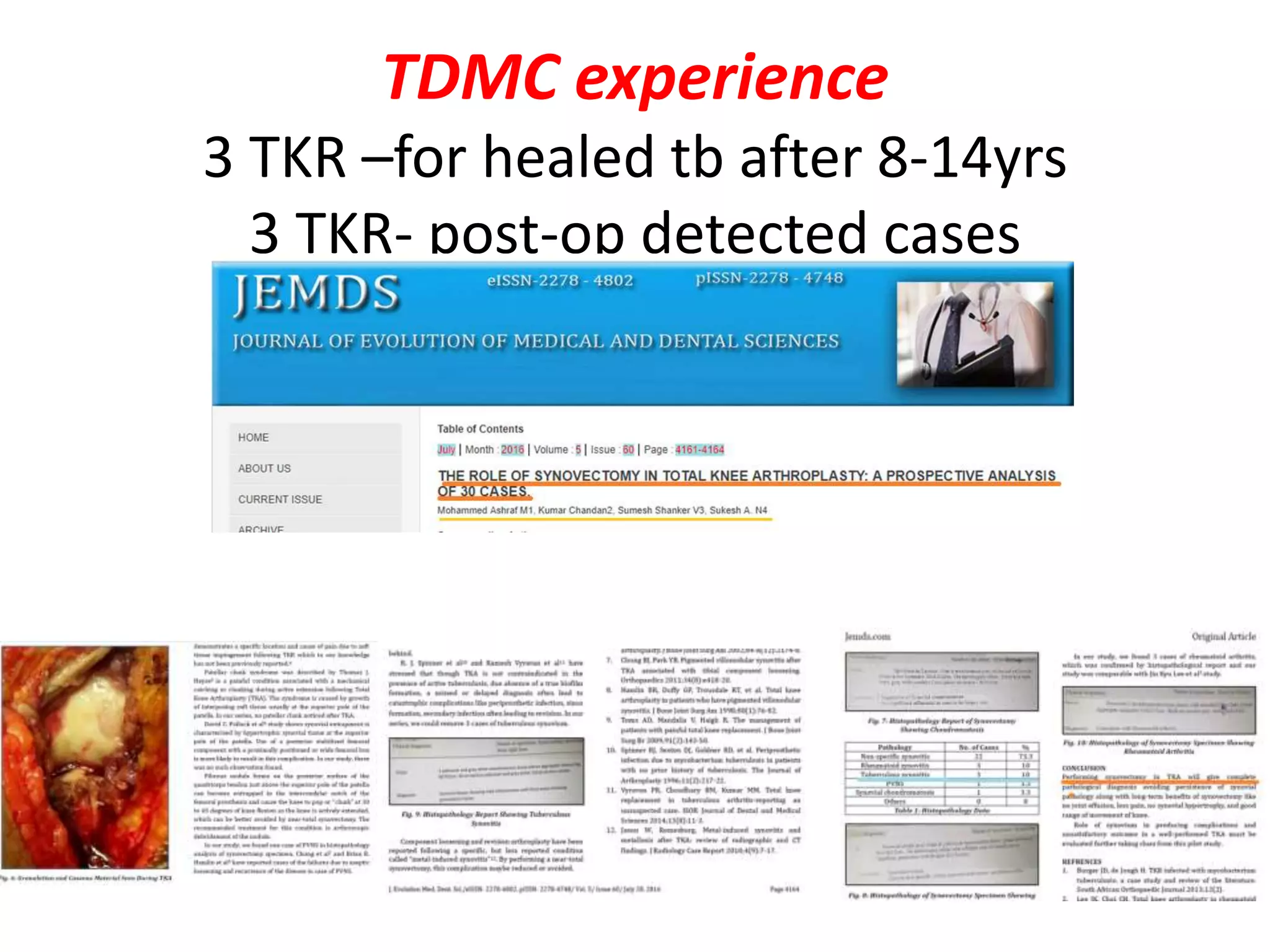 Osteoarticular tuberculosis [bone and joint tb] dr mohamed ashraf,hod ...