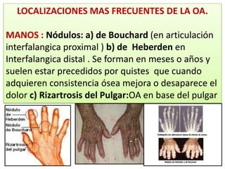 Osteoartritis nuevo tema | PPTX