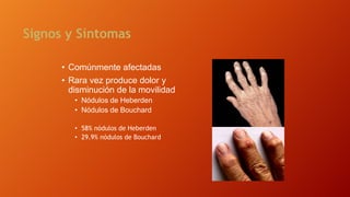 Osteoartrosis | PPTX