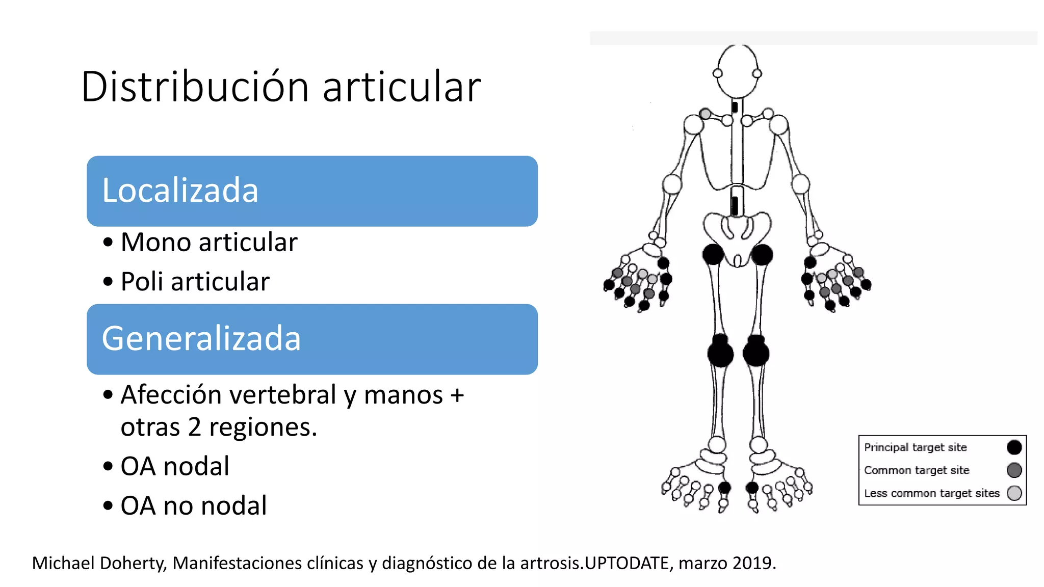 Osteoartrosis manifestaciones clinicas y diagnostico | PPTX