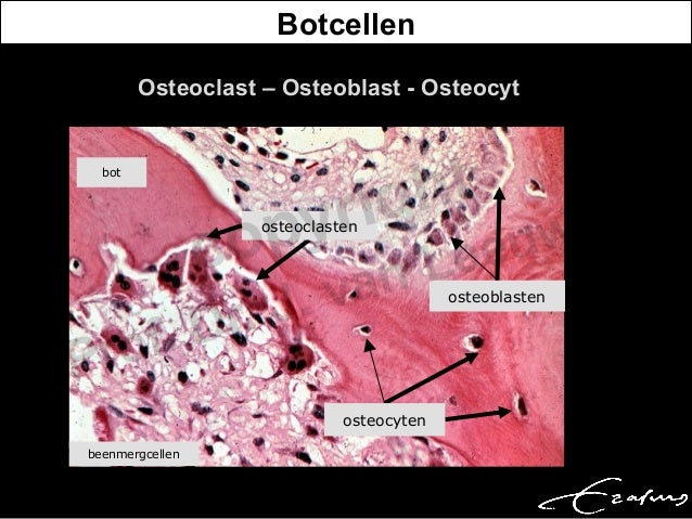 De osteoblast