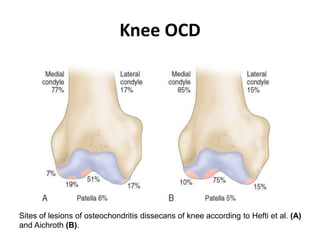 Osteochondritis by a resident presentation seminar | PPTX