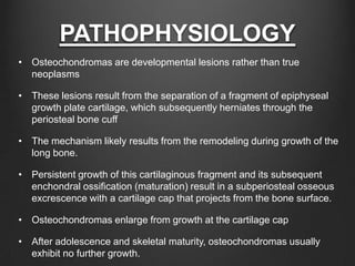 Osteochondroma Pptx