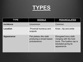 Osteochondroma | PPTX