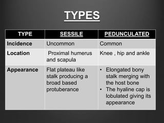 Osteochondroma (dr. mahesh) | PPTX