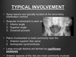 Osteochondroma (dr. mahesh) | PPTX