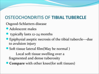 Osteochondrosis | PPT