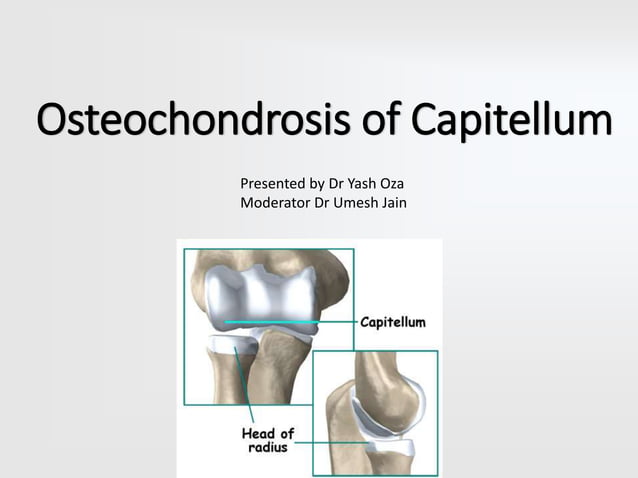 Osteochondrosis of capitellum | PPTX | Bone and Joint Conditions ...