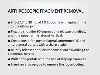 Osteochondrosis of capitellum | PPT