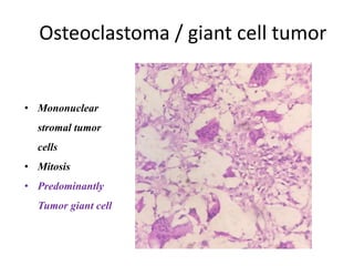 osteoclastoma.pptx with a wide description | PPT