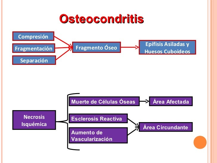 Osteocondritis