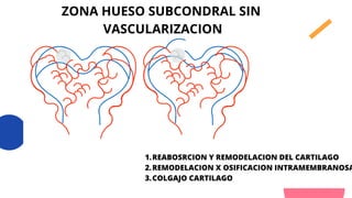 OSTEOCONDRITIS DISECANTE.pdf