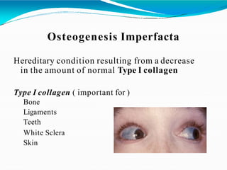 Osteogenesis Imperfecta