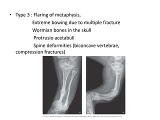 Osteogenesis imperfecta | PPTX