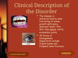 Osteogenesis imperfecta management surgery.ppt