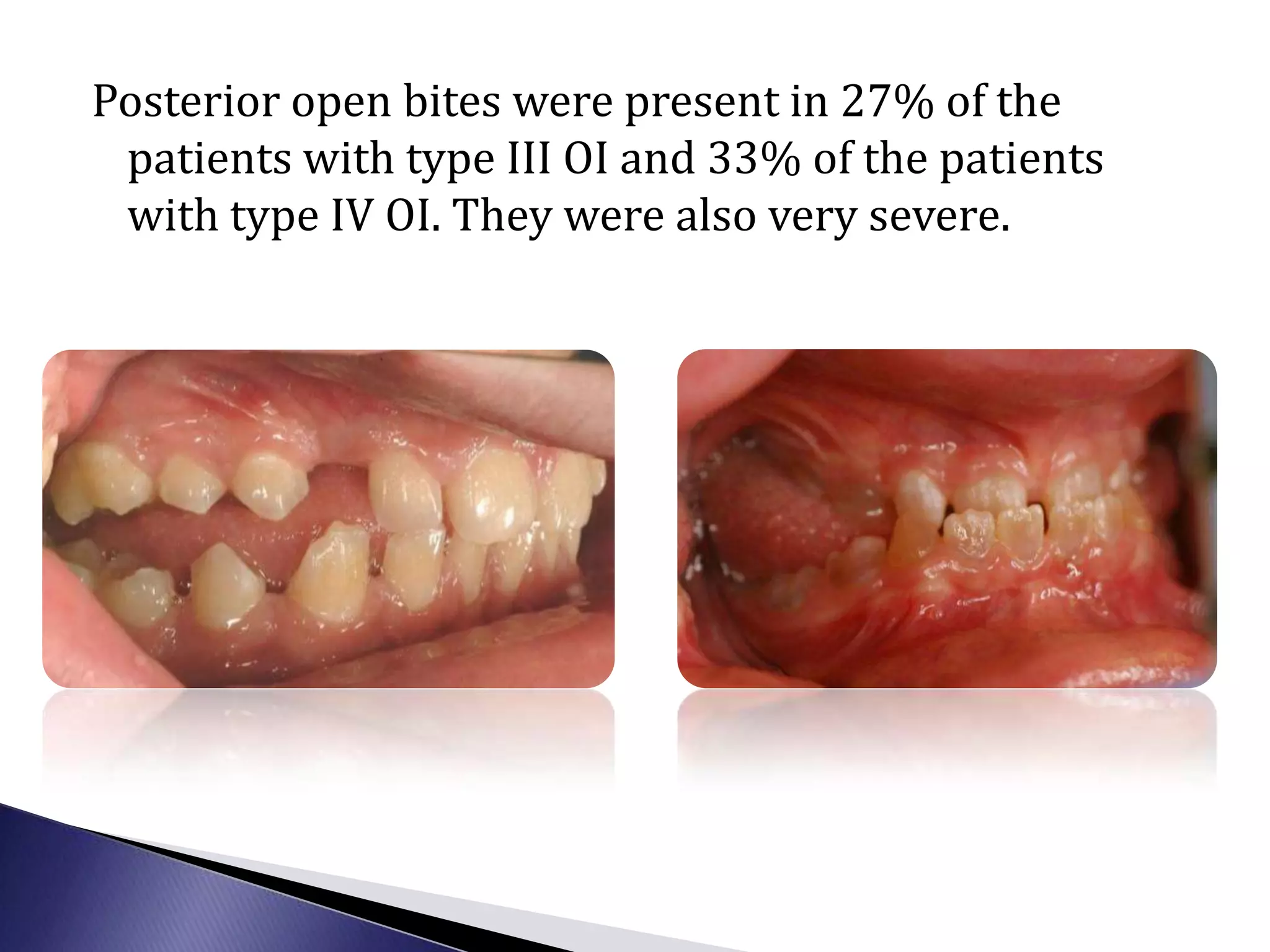 Dental management of Osteogenesis imperfecta.slideshare | PPTX